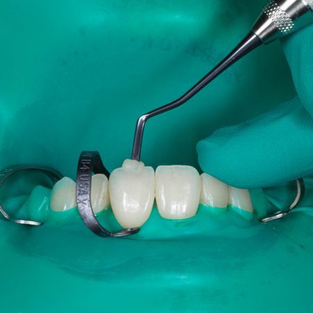 Dental Dam, Latex, Powder-Free/Low Protein, Green, Heavy, Mint 19201 ...